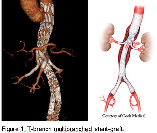 臺北榮民總醫院 - 新聞稿